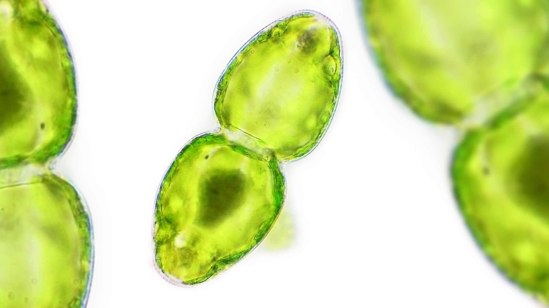 Navigating Neurodegenerative Diseases with Microalgae Supplements: A ...